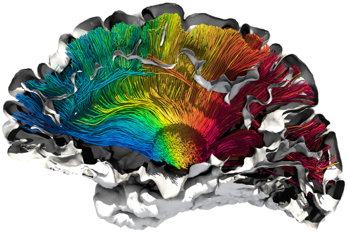 CNIR Group - Dogu Baran Aydogan